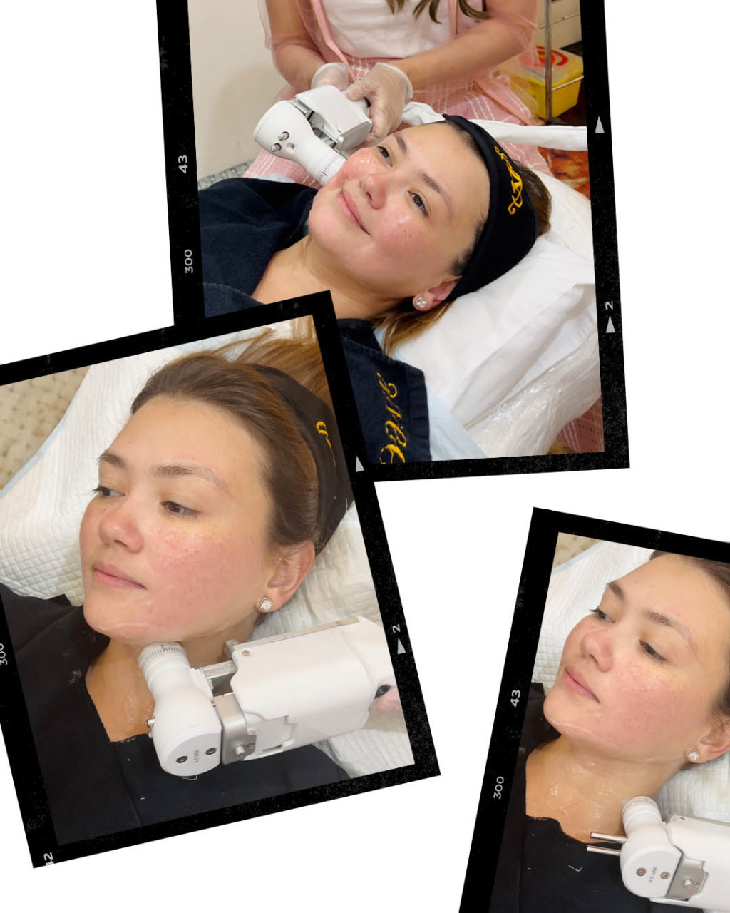 Feel First-Class With Aivee Clinic’s Best Treatments of 2022